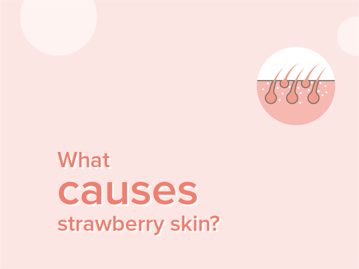 Community Asks: Strawberry Skin - InSync Blog by Nua